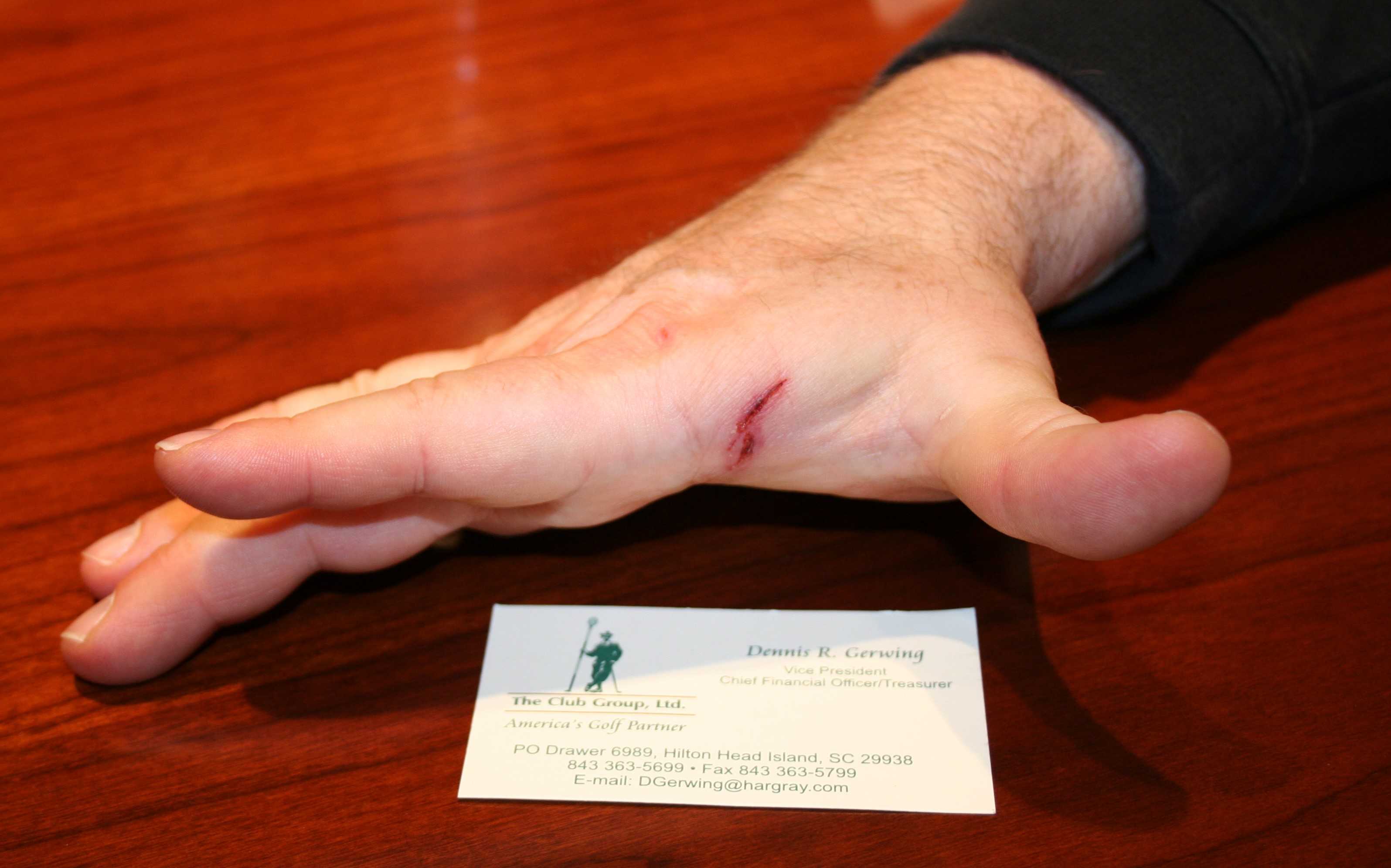 UNSOLVED DISAPPEARANCE: ELIZABETH AND JOHN CALVERT – LAST SEEN ALIVE